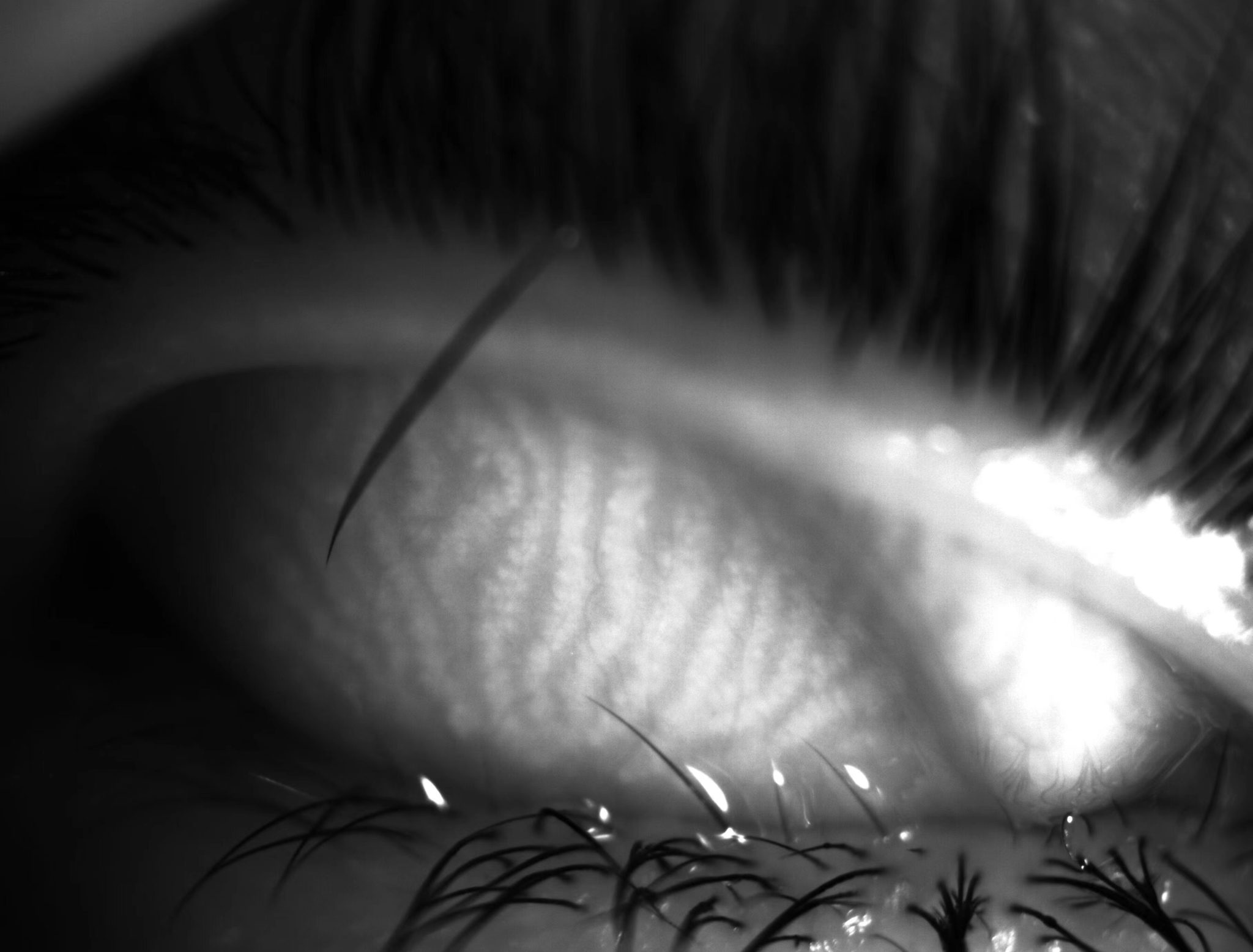 Digital Slit Lamp with Meibomian Imaging MainTech SL-3SC - Lenscan ...