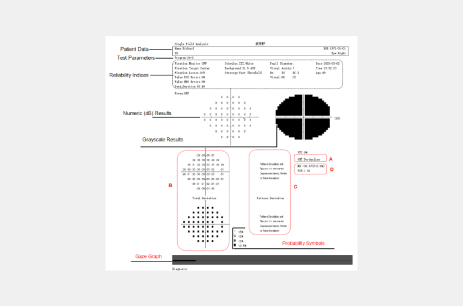 Automatic Perimeter SYSEYE BIO-1000 Plus - Lenscan Medical Inc.