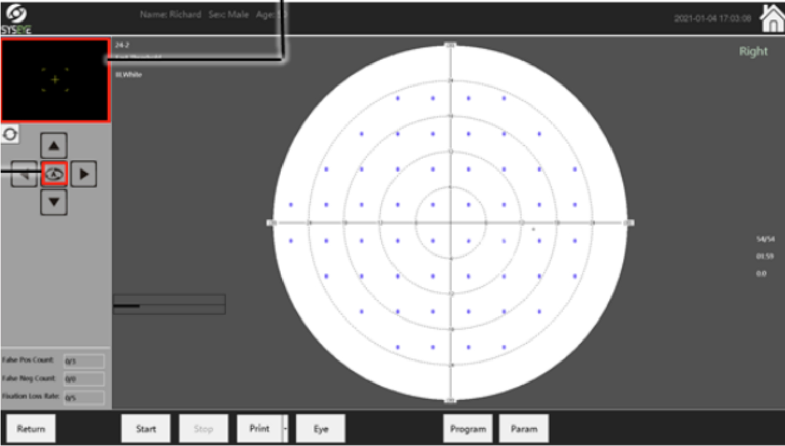 Automatic Perimeter SYSEYE BIO-1000 Plus - Lenscan Medical Inc.