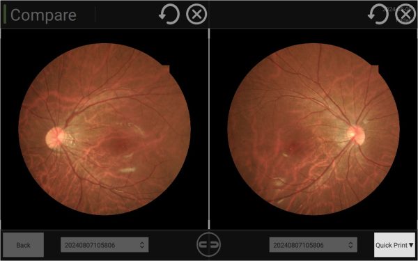 Non-Mydriatic Fundus Camera SYSEYE Kestrel 3100m - Lenscan Medical Inc.