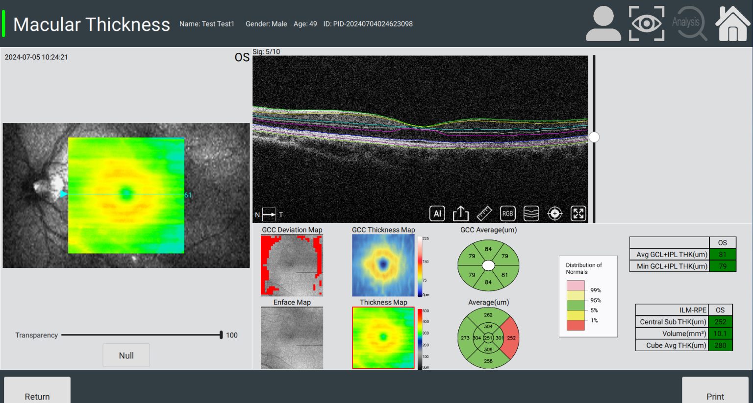 Optical Coherence Tomography OCT RetiView500 - Lenscan Medical Inc.