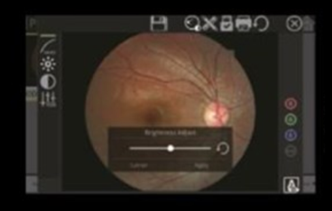 Non-Mydriatic Fundus Camera SYSEYE Kestrel 3100m - Lenscan Medical Inc.